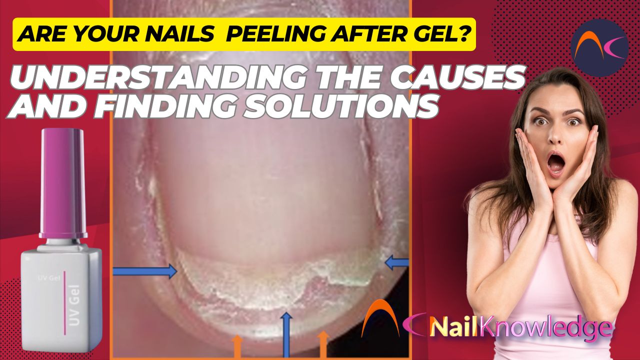 Unhas descascando depois de gel? Aqui está o que você precisa saber ...